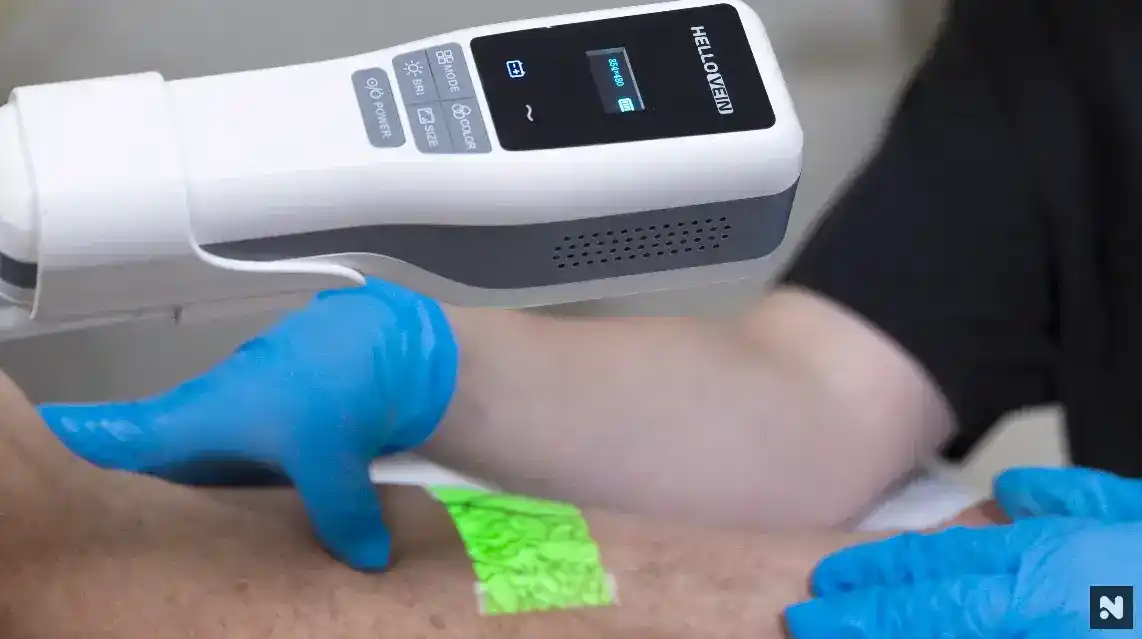 Hellovein ® | Clinical Gallery