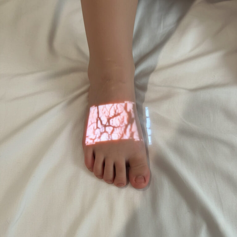 Hellovein® Vein Finder | For Difficult Venous Access